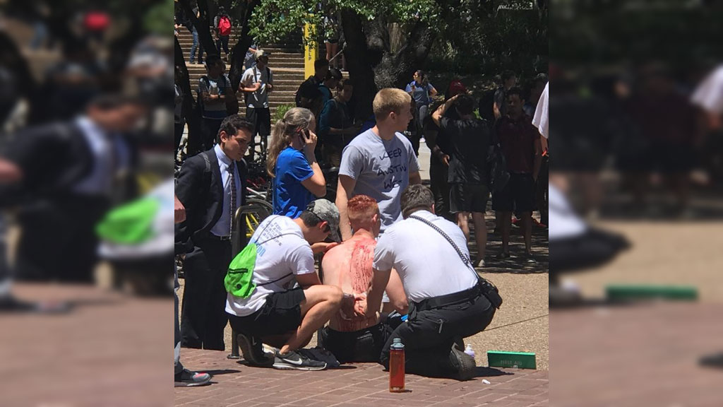 'He was so calm I almost didn't realize an attack was happening ...